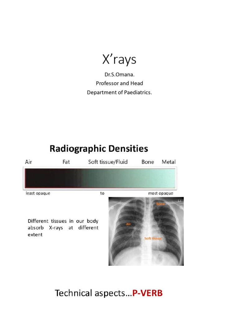 Pediatric X Ray | PDF