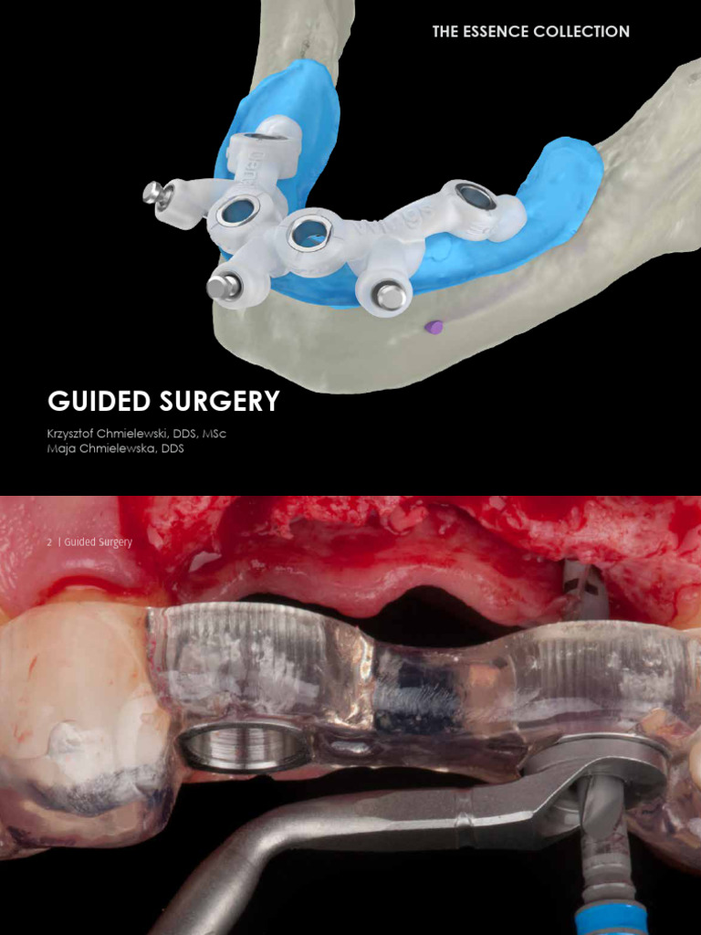 Straumann Guided Surgery 2020 | PDF
