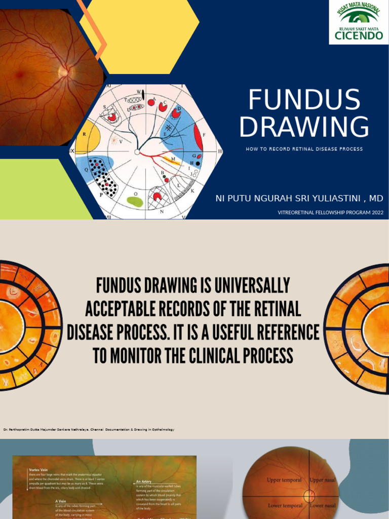 Retinal Fundus Drawing Oktober | PDF