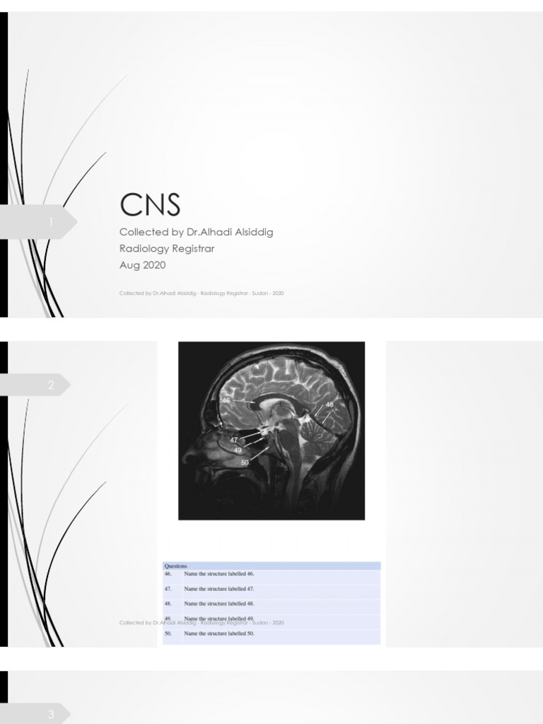 Anatomy CNS | PDF