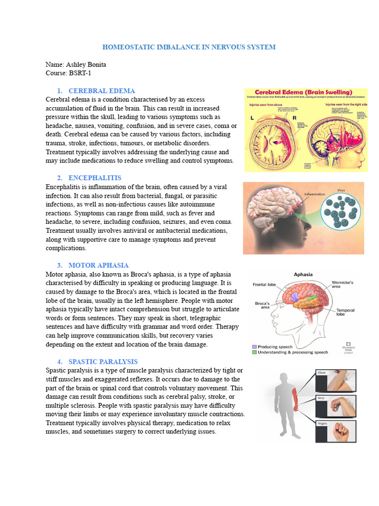 Nervous System Homeostatic Imbalance | PDF