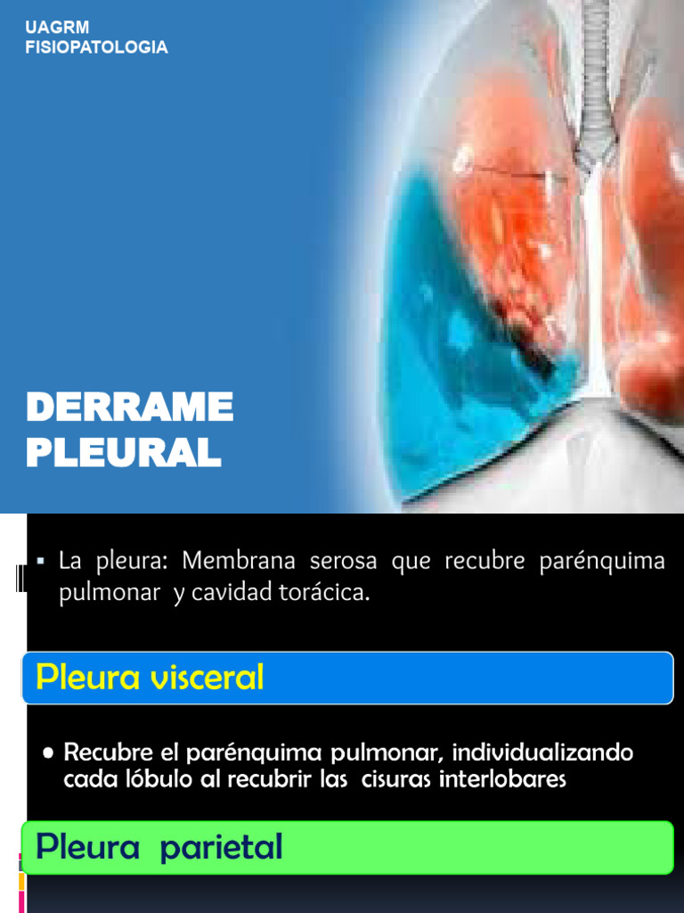 Derrame Pleural 2024 | PDF