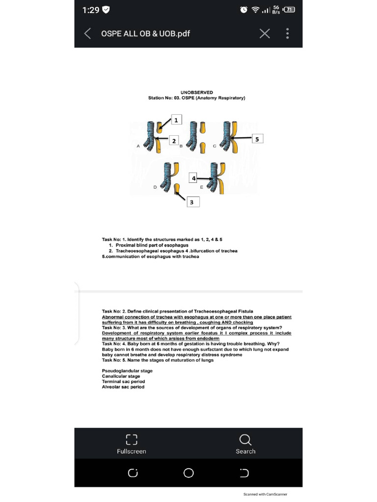 Respo Ospe Solved | PDF