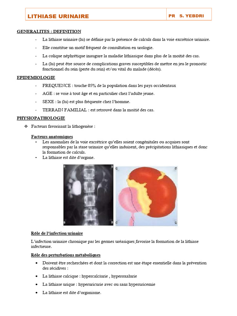5-Lithiase Urinaire | PDF