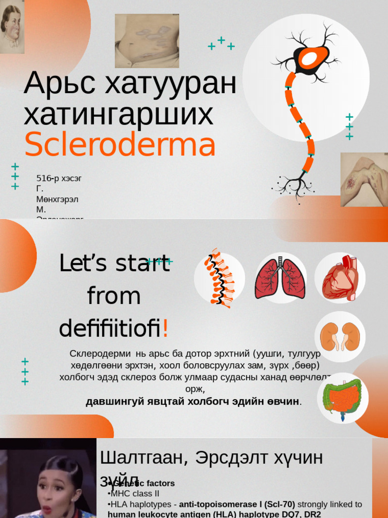 Scleroderma | PDF