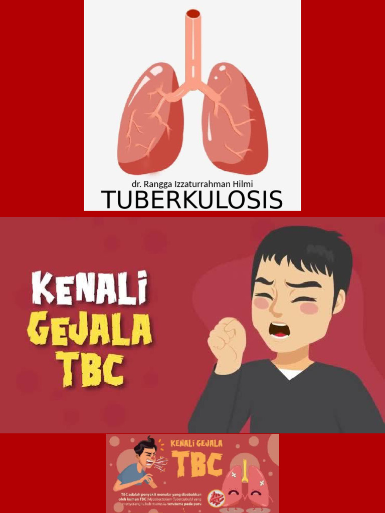 Tatalaksana TBC | PDF