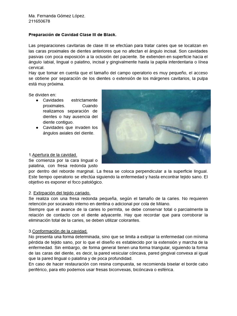 Preparación Clase III, IV y V de Black | PDF