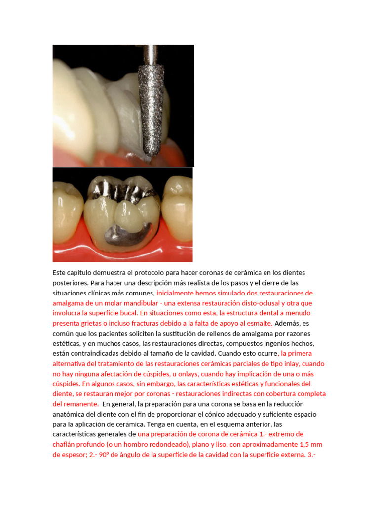 Coronas Convencionales Resumen | PDF
