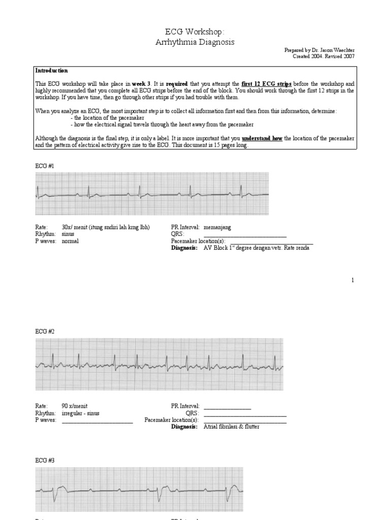 ECG Workshop 2006 | PDF | Electrocardiography | Artificial Cardiac Pacemaker