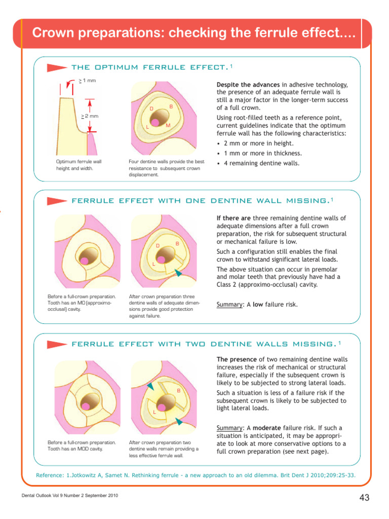 Ferrule Effect | PDF