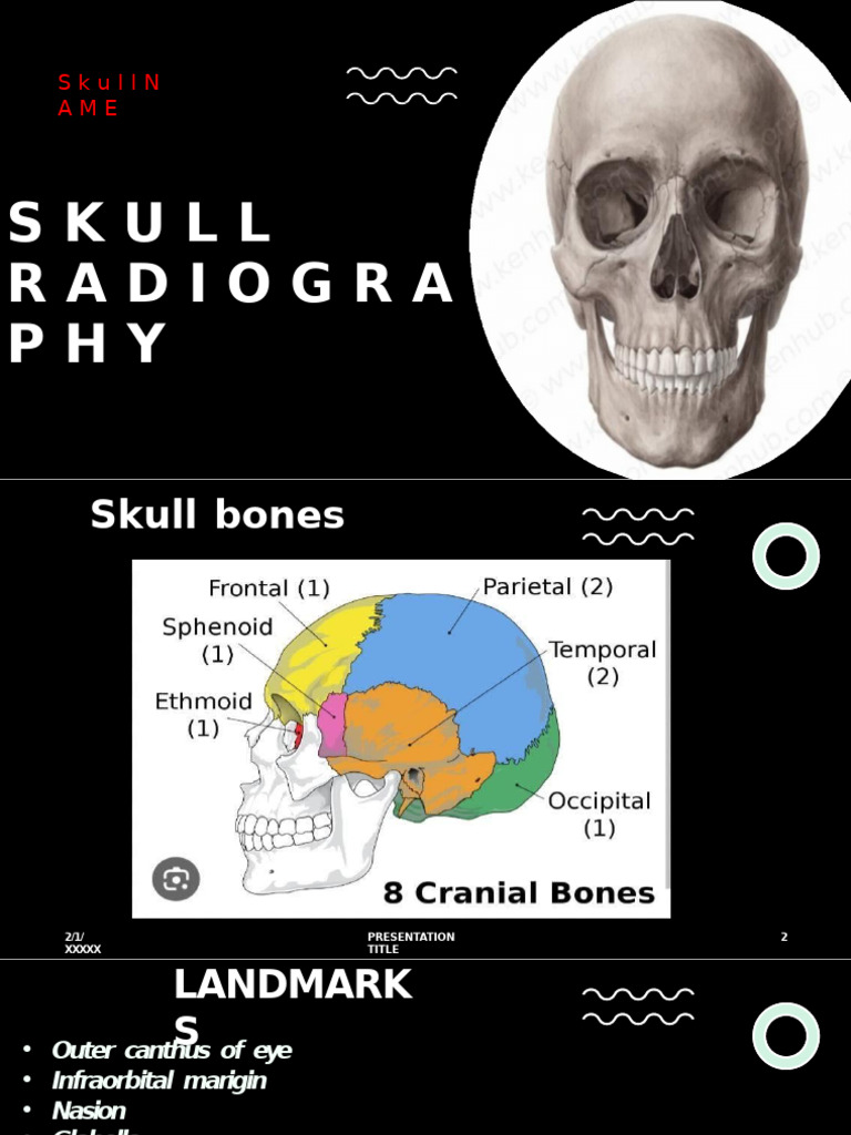 Skull | PDF