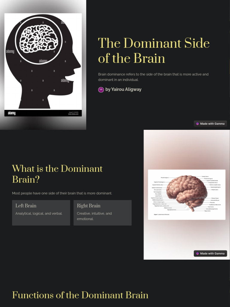 The Dominant Side of The Brain | PDF