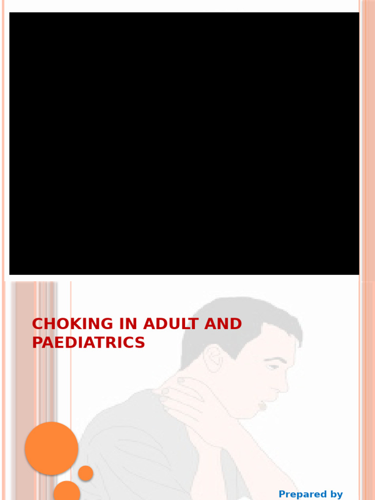 Choking | PDF