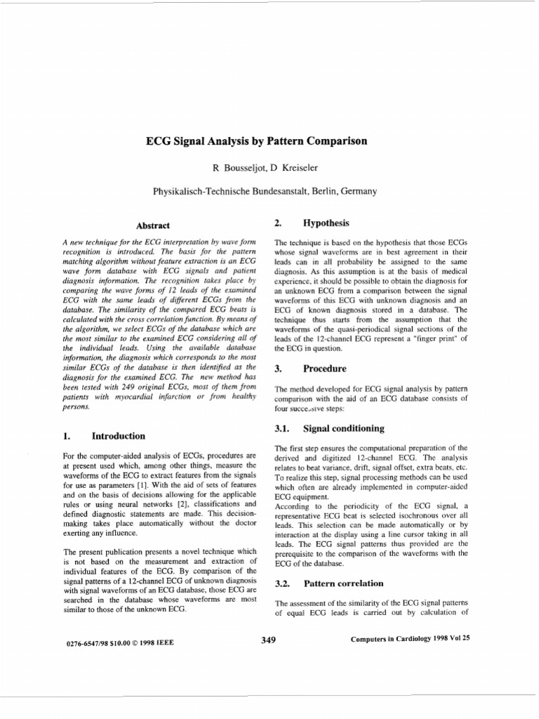 ECG Signal Analysis by Pattern Comparison | PDF | Electrocardiography | Correlation And Dependence