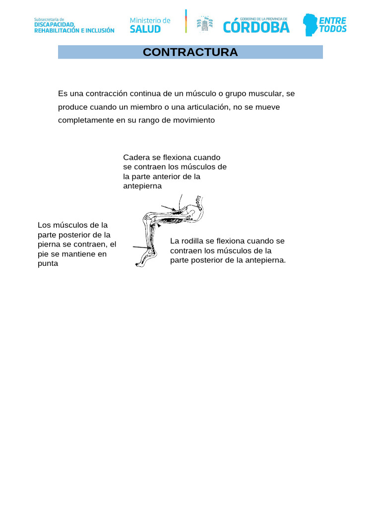 Contractura | PDF