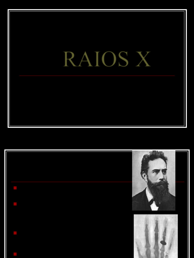 Raios X | PDF
