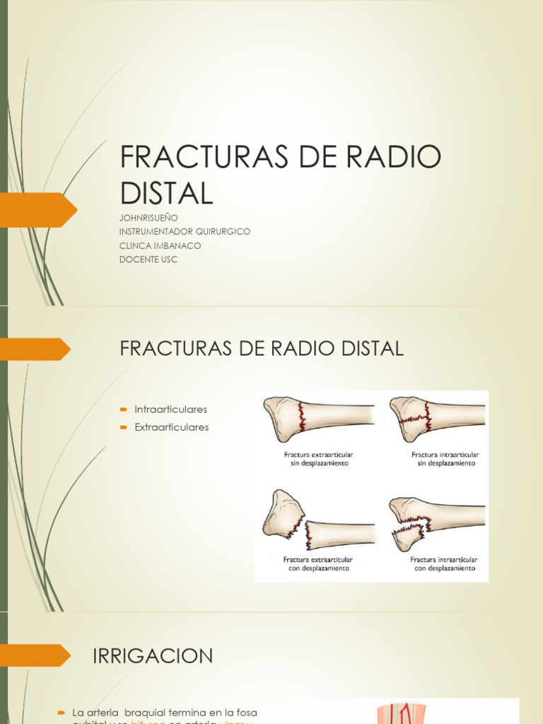Fracturas de Radio Distal | PDF