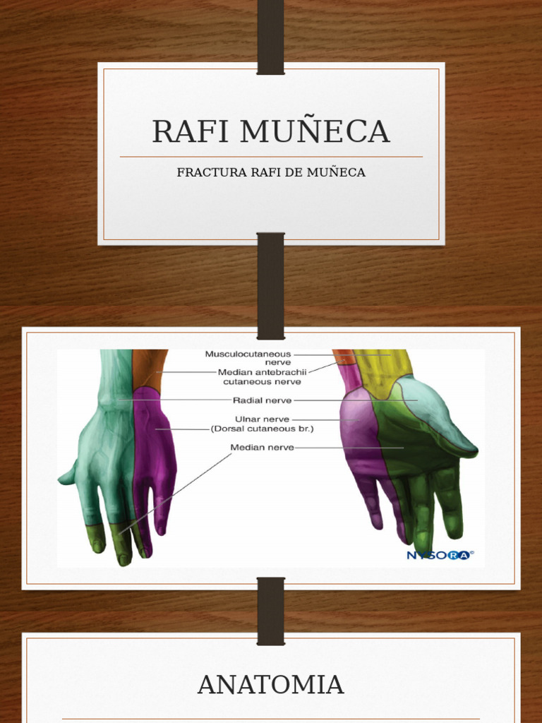 Rafi Muñeca | PDF