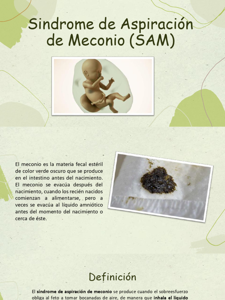 Sindrome de Aspiración de Meconio | PDF