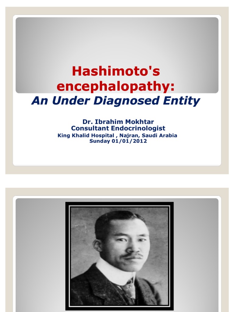 Hashimoto Encephalopathy | PDF | Thyroid | Hypothyroidism
