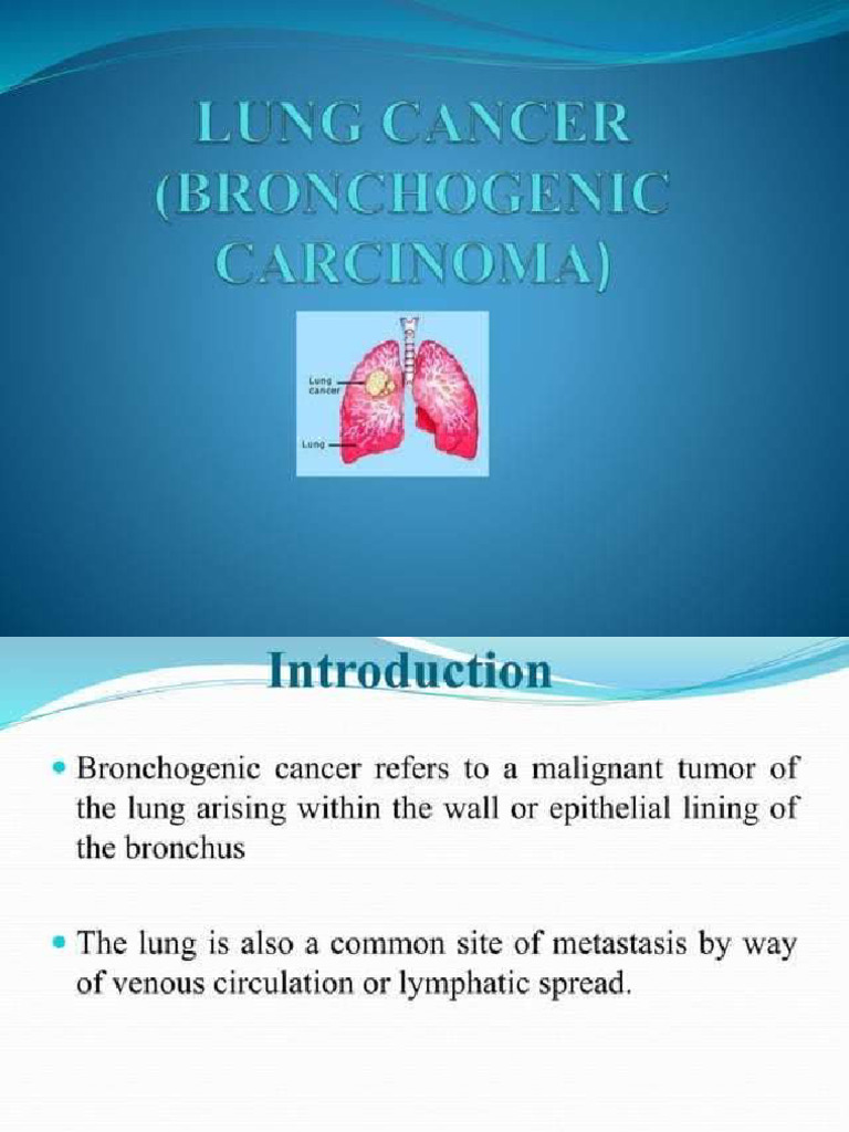lUNG cANCER | PDF