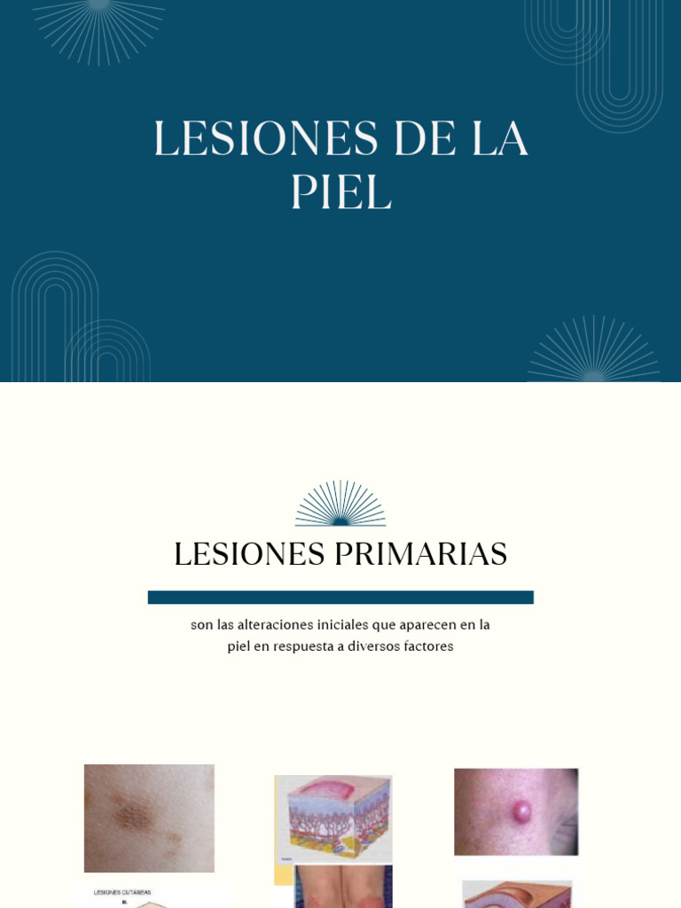 Lesiones de La Piel | PDF | Piel | Anatomía