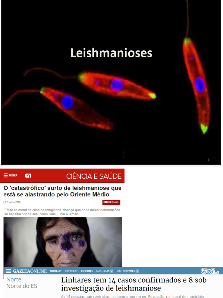 Aula 4 - Leishmanioses | PDF | Leishmania | Imunologia