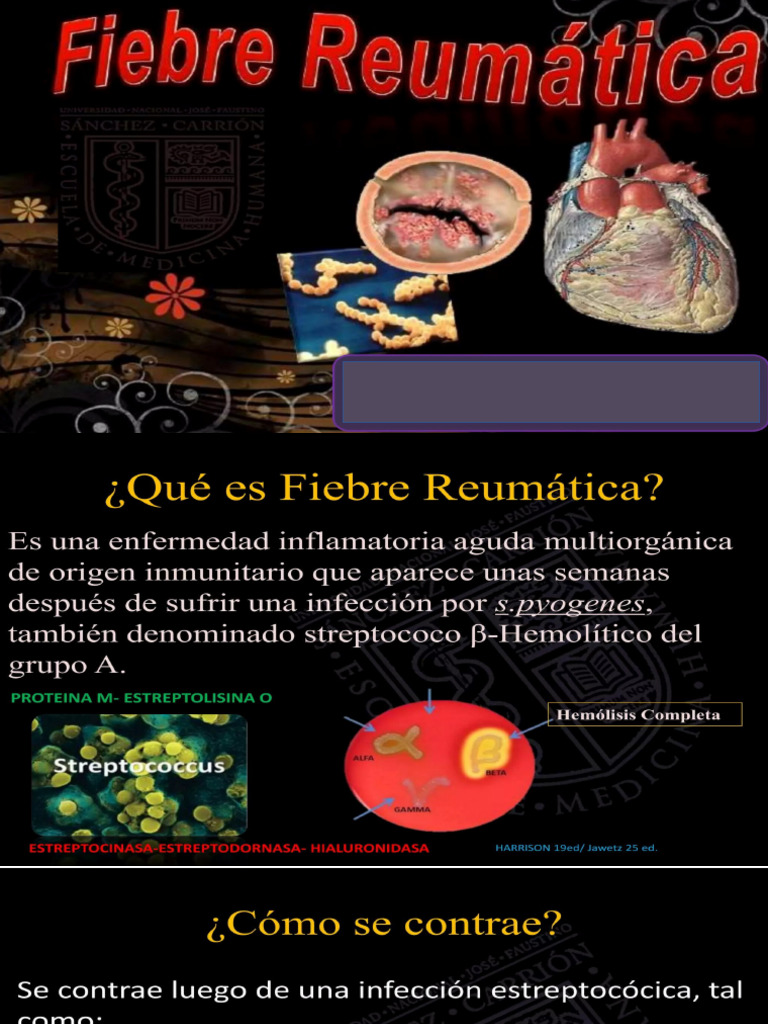 Fiebre Reumatica | PDF