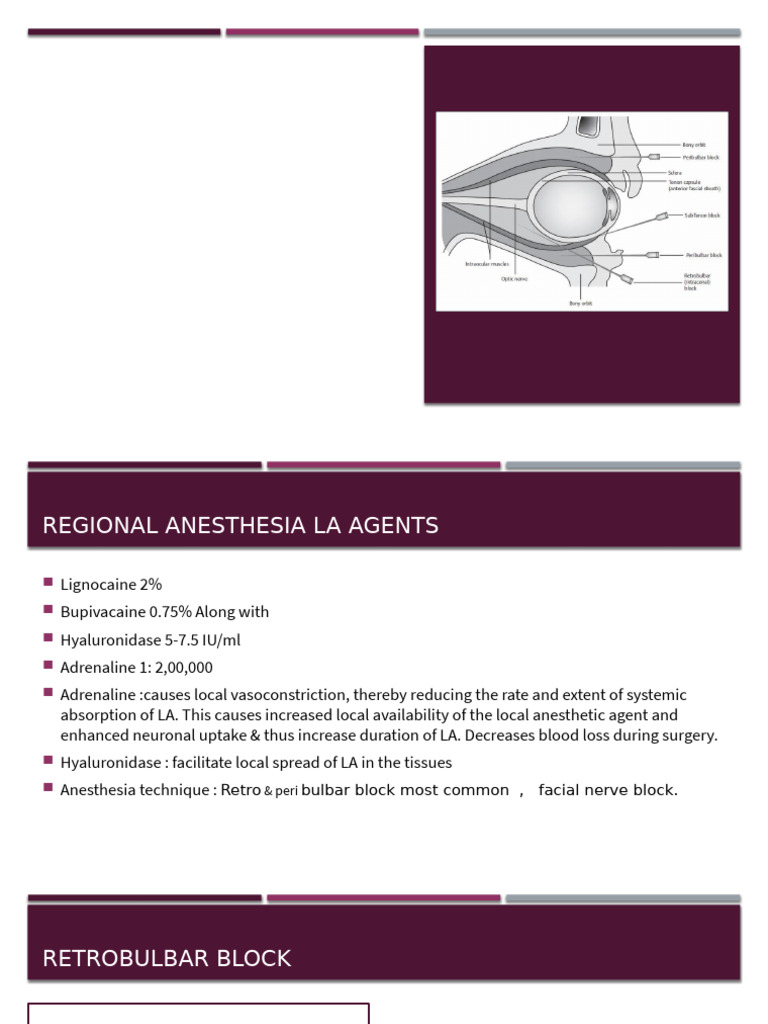 Regional Anesthesia For Opthal Surgery | PDF