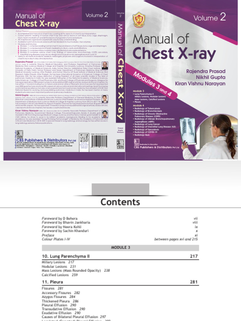 Manual of chest xray | PDF