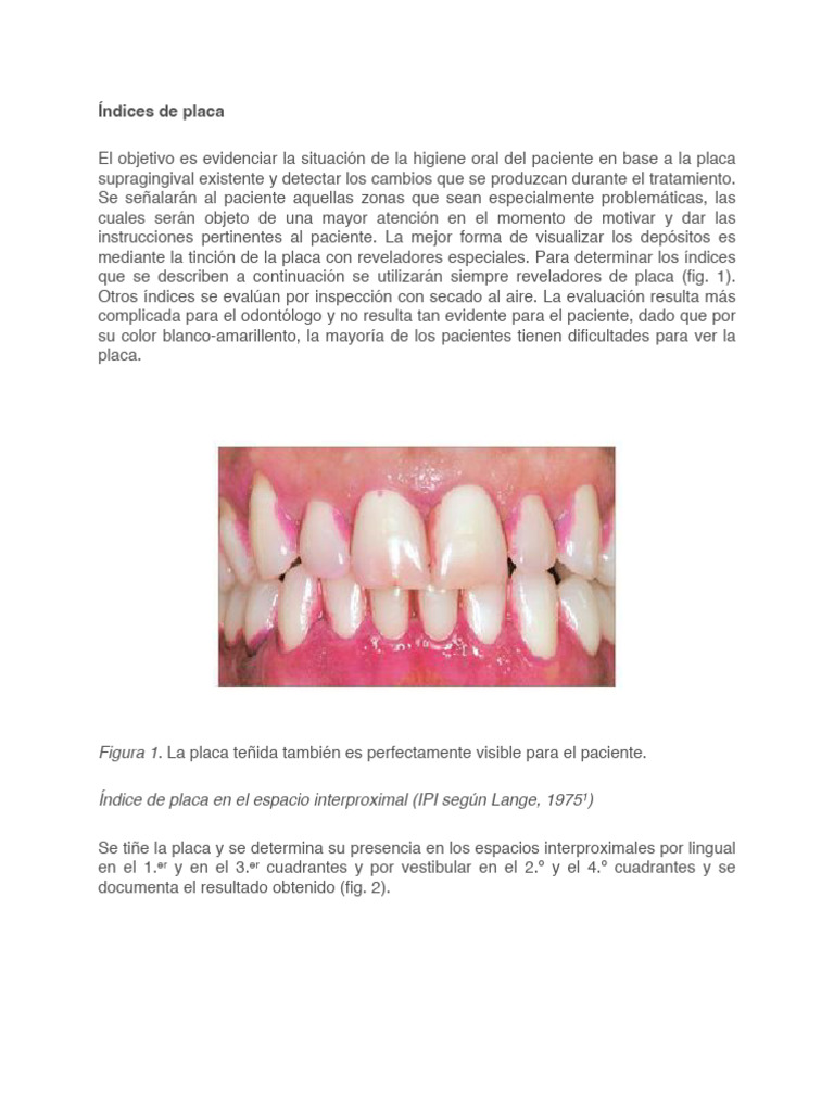 indice de placa bacteriana | PDF