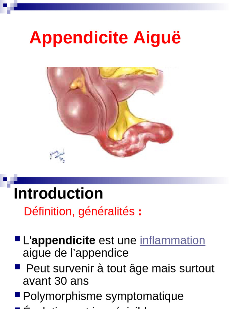 Appendicite | PDF