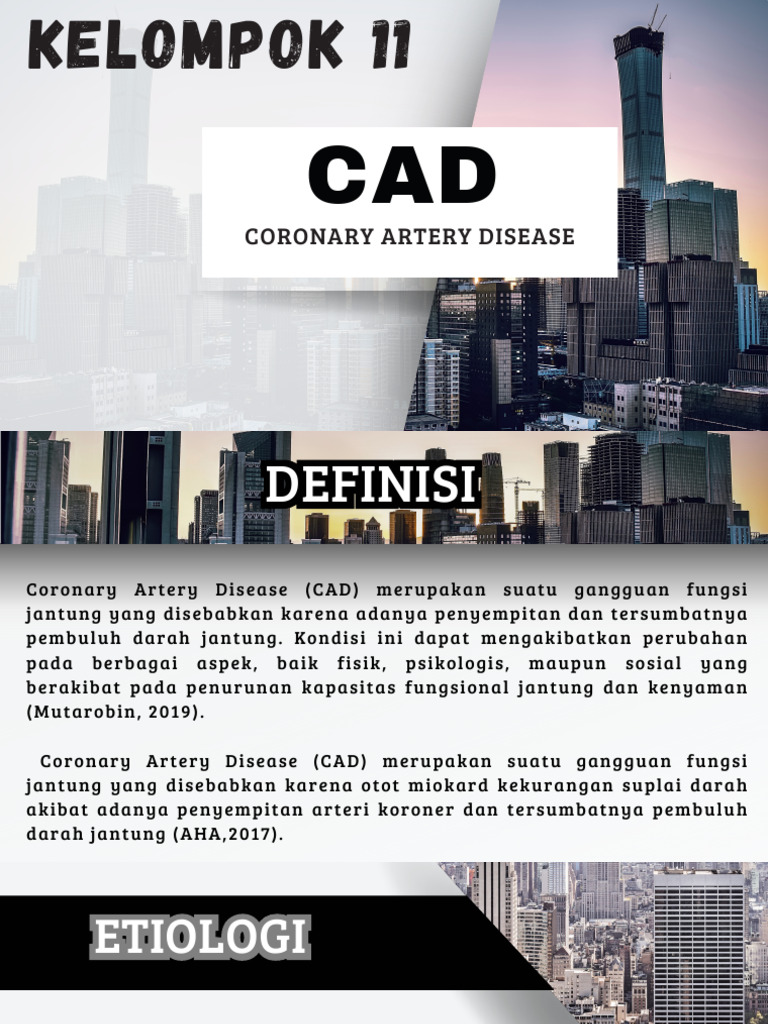 KLP 11 CAD - 20240926 - 074759 - 0000 | PDF
