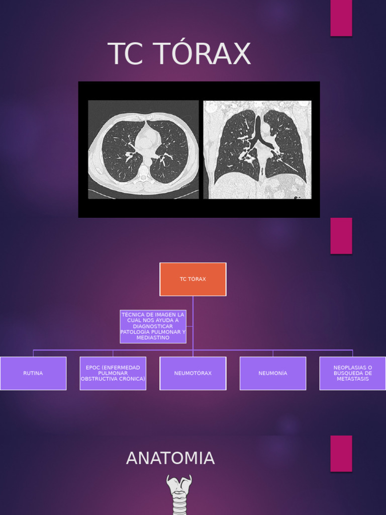 Protocolo TC Tórax y EPOC | PDF