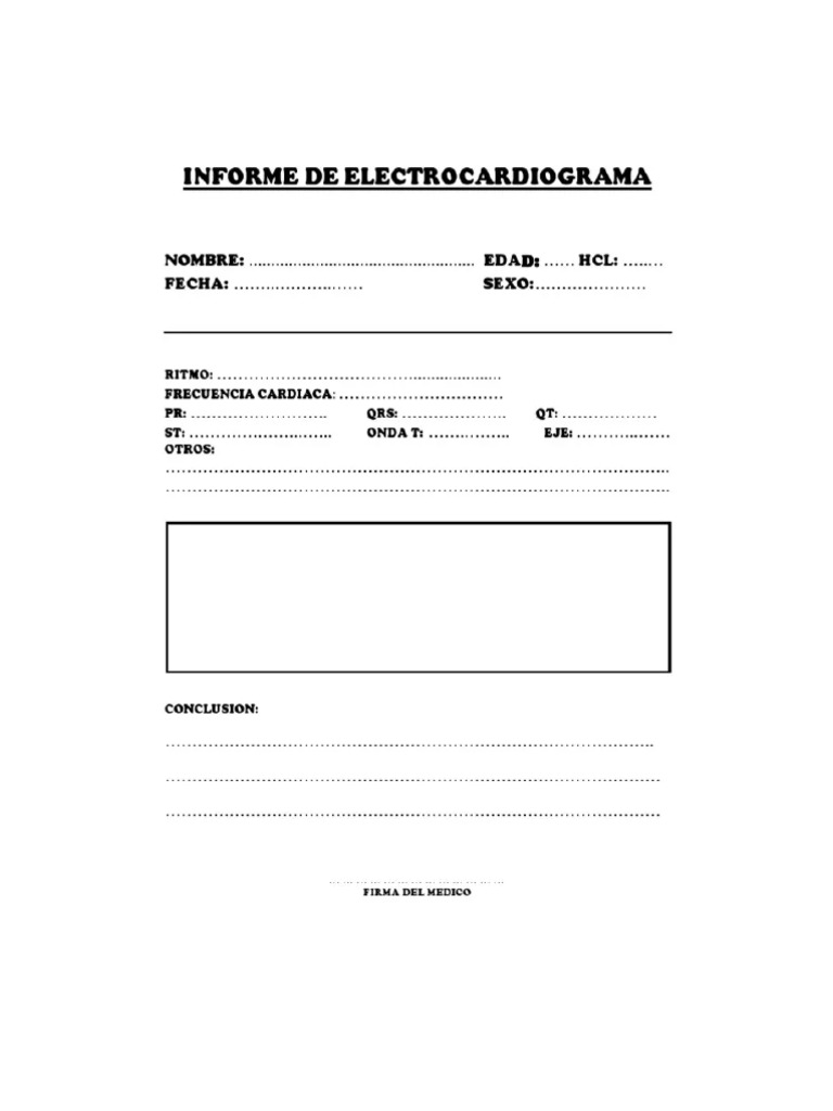 Informe Ekg | PDF