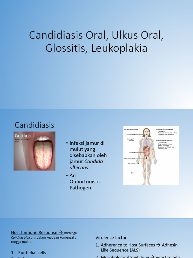Candidiasis Oral, Ulkus Oral, Glossitis, 2024 | PDF
