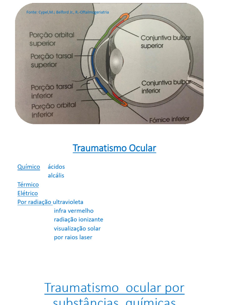 Trauma ocular com subst僴cias qu icas | PDF