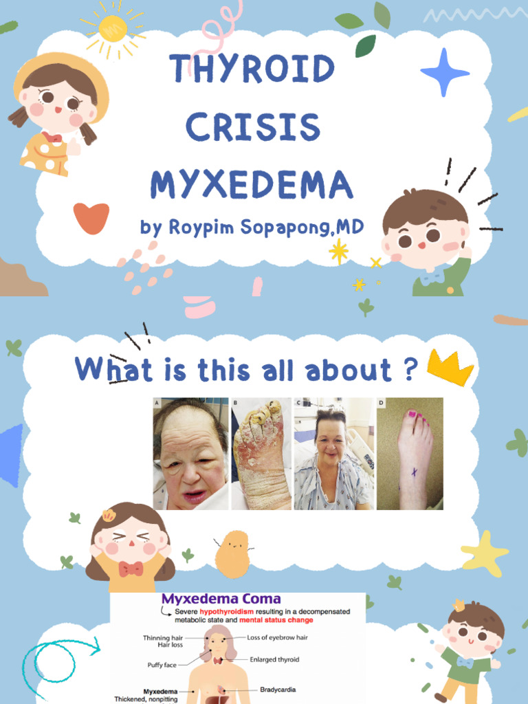 Myxedema Ready to Use | PDF