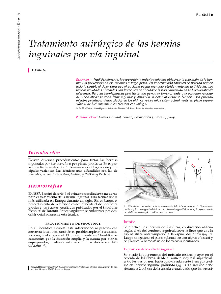 Tratamiento Quirúrgico de Las Hernias Inguinales Por Via Inguinal | PDF