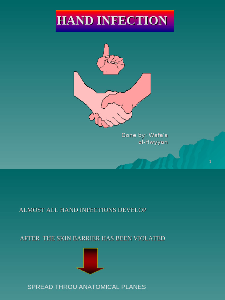 Hand Infections | PDF