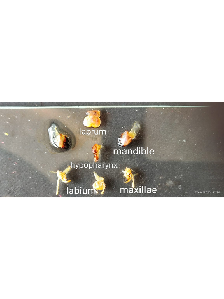 Chethan Dissection | PDF