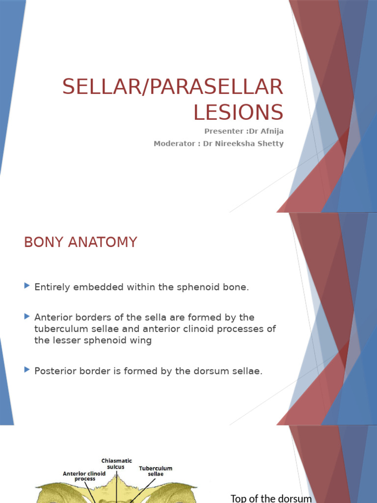 Sellar Lesion | PDF