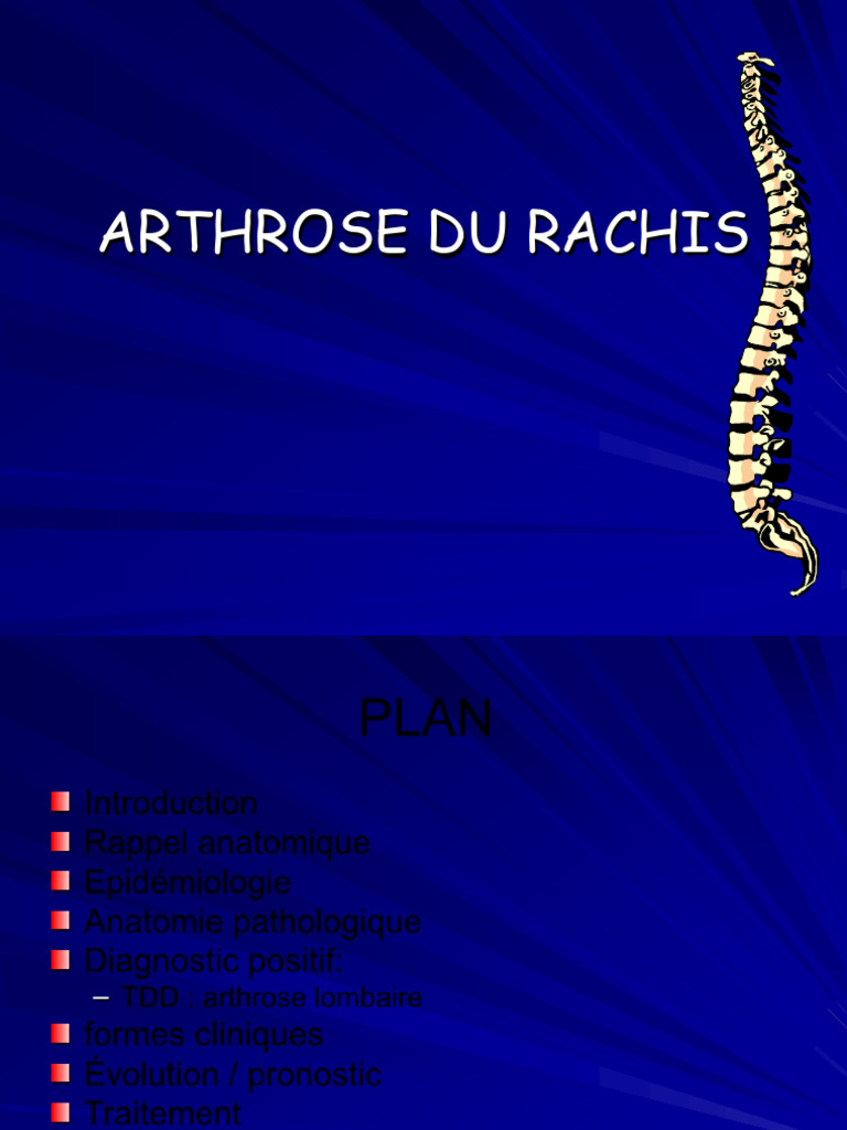 Arthrose du Rachis : Diagnostic et Traitement | PDF | Human Anatomy ...