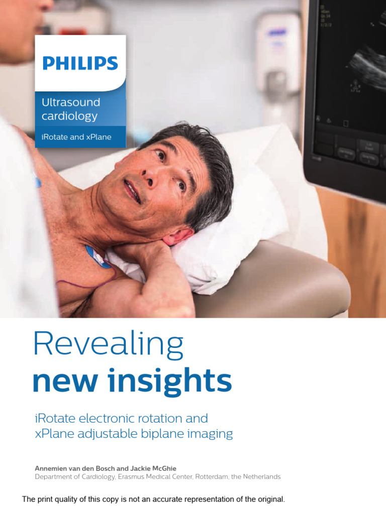 Irotate and Xplane | PDF