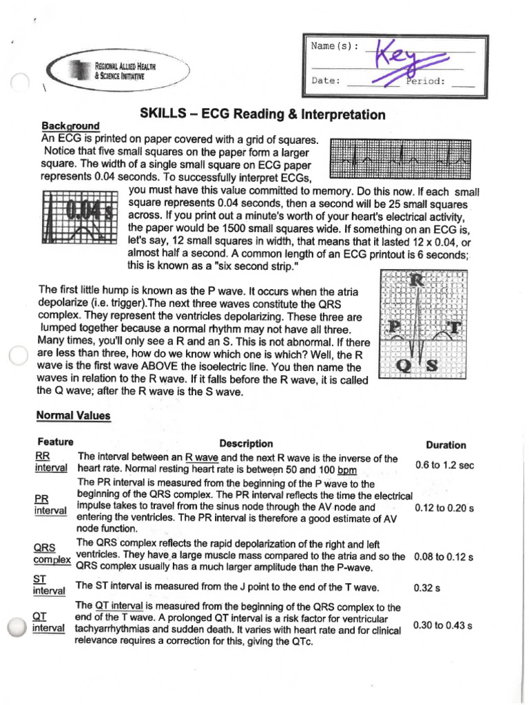 (ELearn) EKG Introduction ANSWER KEY | PDF