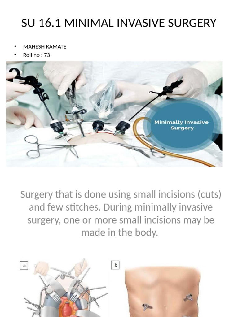 Minimal Invasive Surgery | PDF