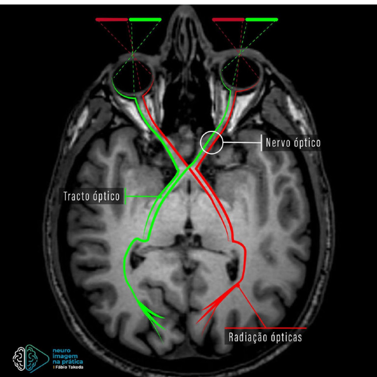 Neurooftalmolpgia DR DILVAN 2 | PDF