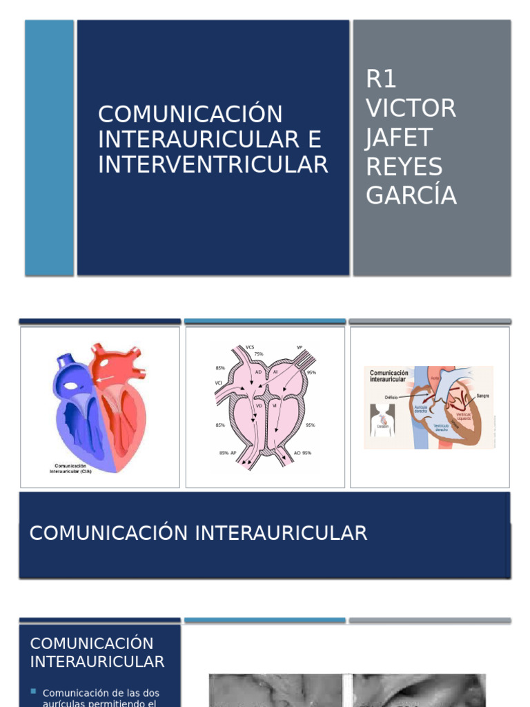 Comunicación Interauricular e Interventricular | PDF