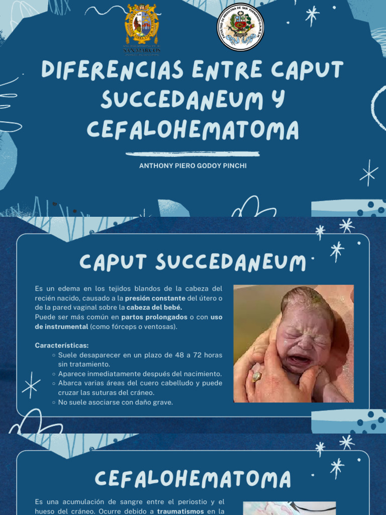 Diferencias Entre Caput Succedaneum y Cefalohematoma | PDF