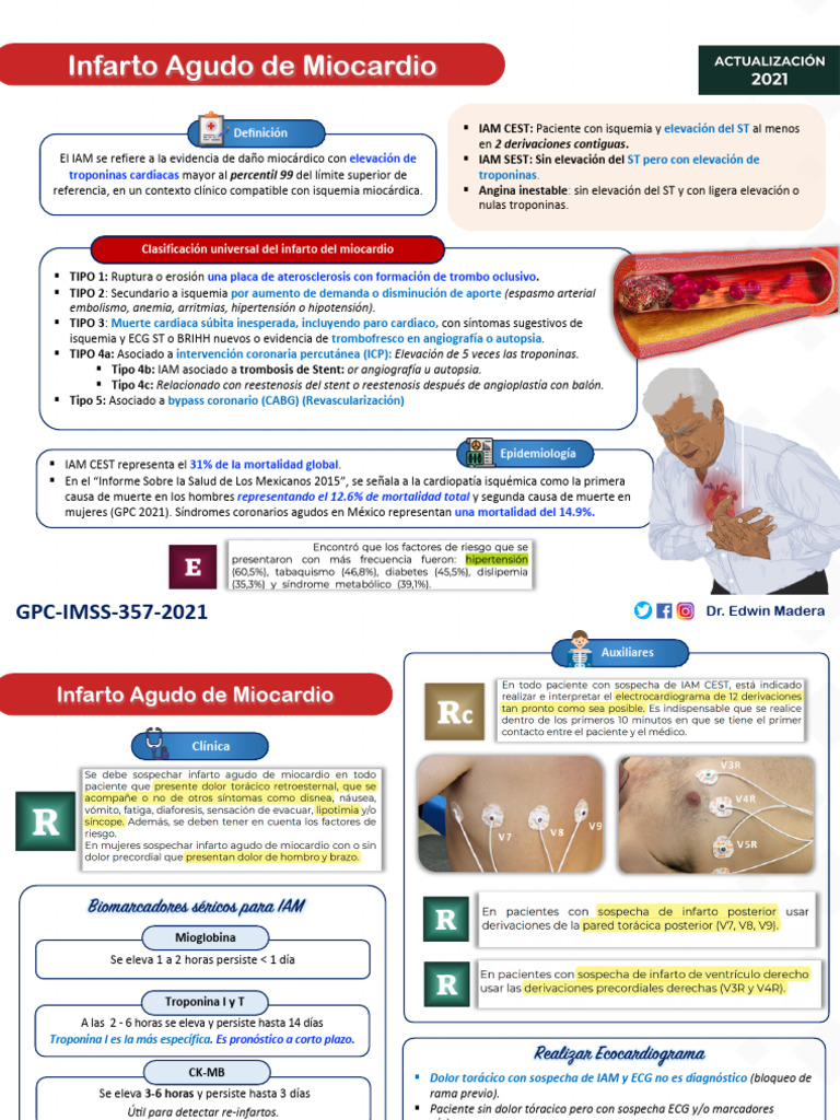 Infarto Agudo de Miocardio | PDF